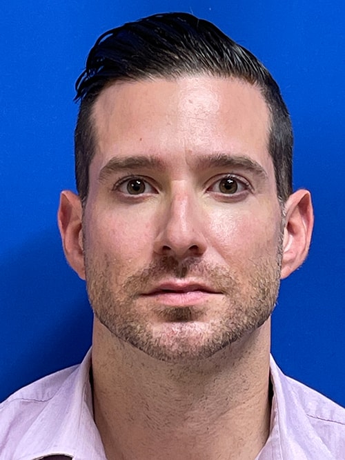 What are the Different Types of Nose Shapes?